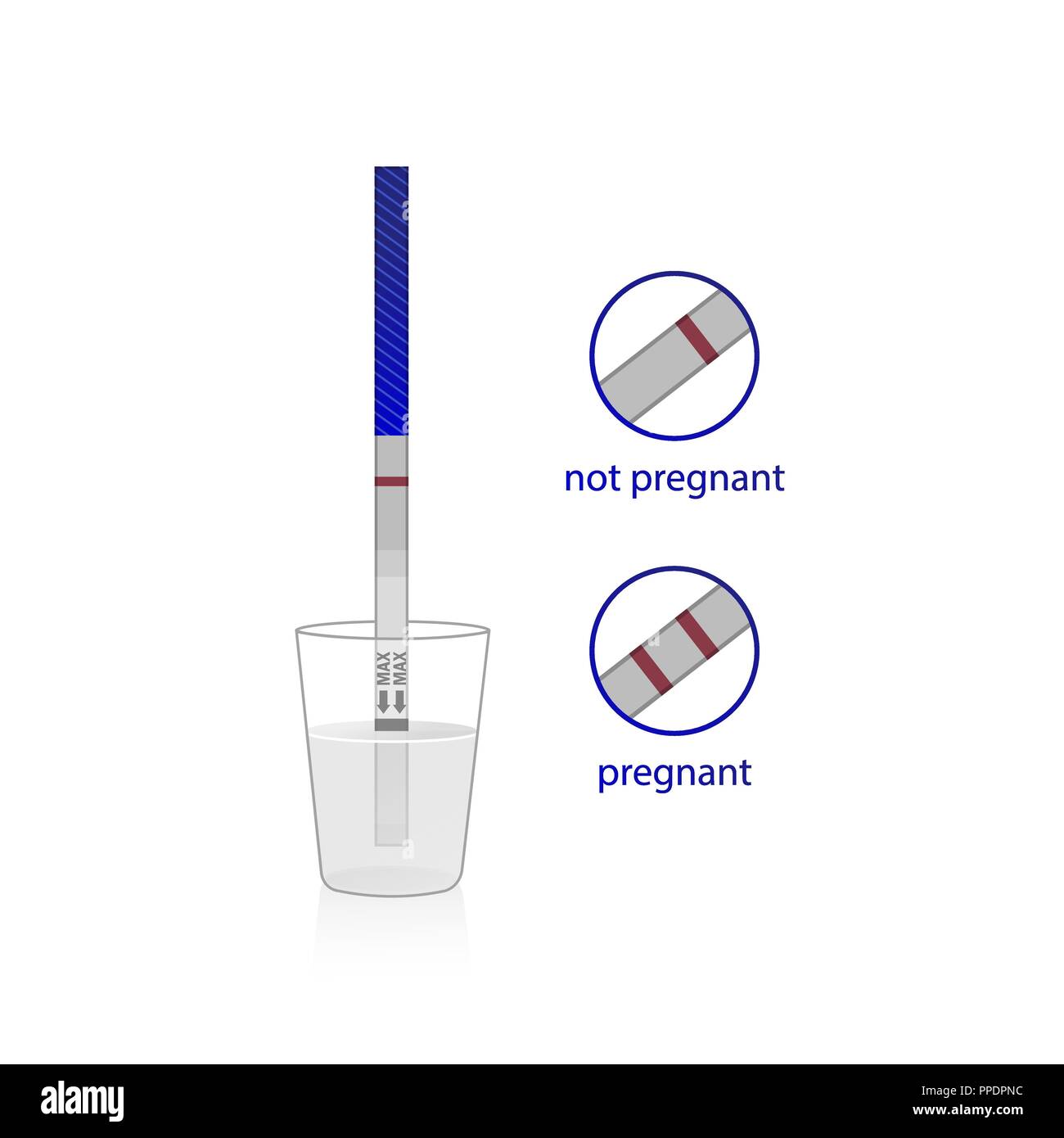 Pregnancy test set. Positive and negative pregnancy tests Stock Vector ...