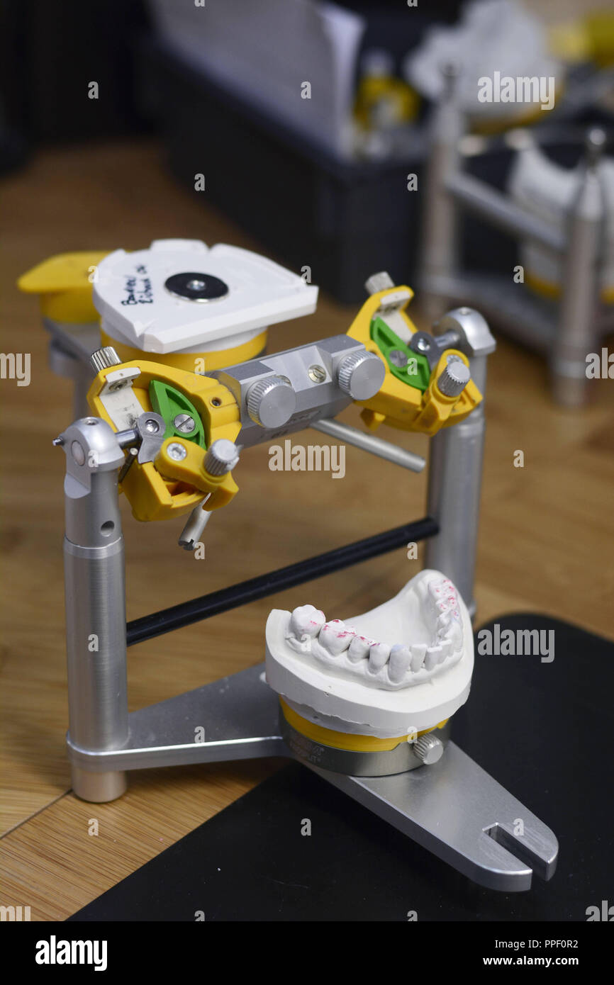 Dental cast in the dental laboratory at Dental Clinic Implaneo, Richard ...