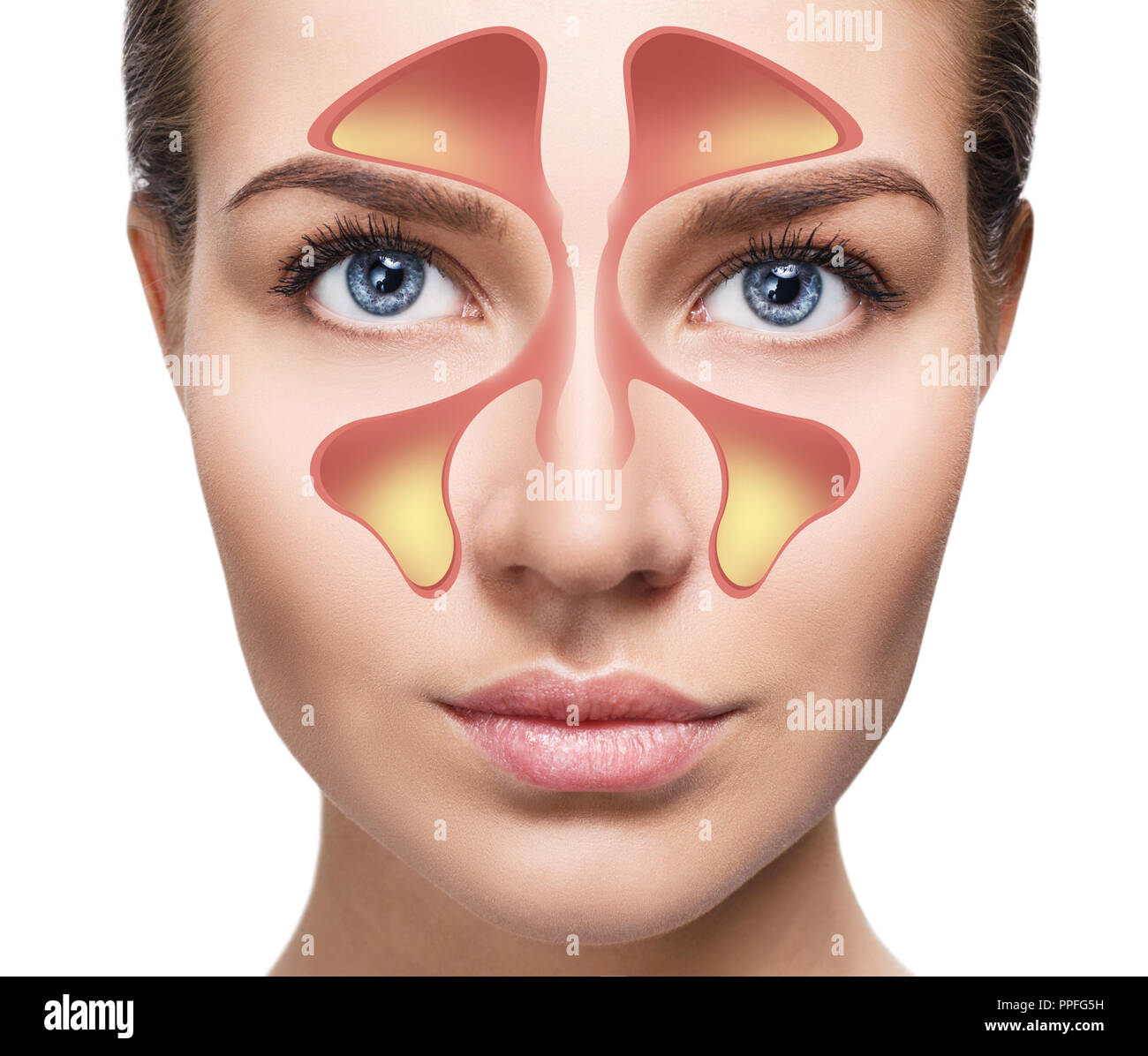 Nasal poly hi-res stock photography and images - Alamy