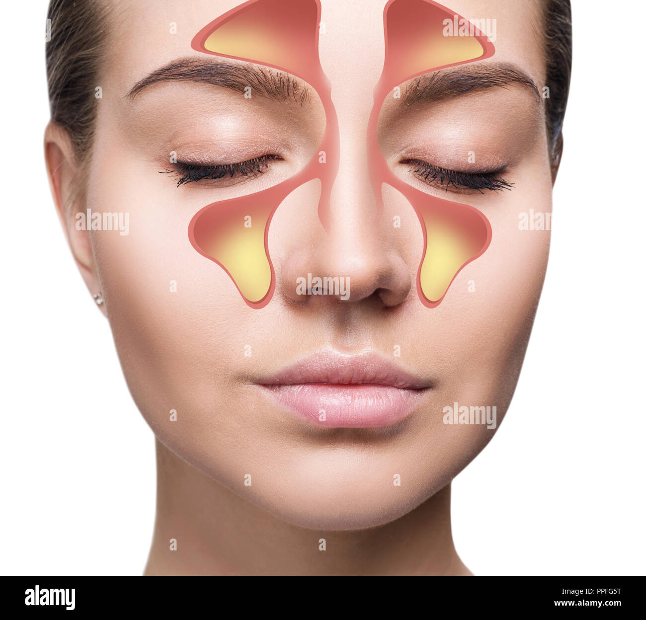 Female face shows nasal sinus with cold over white background Stock ...