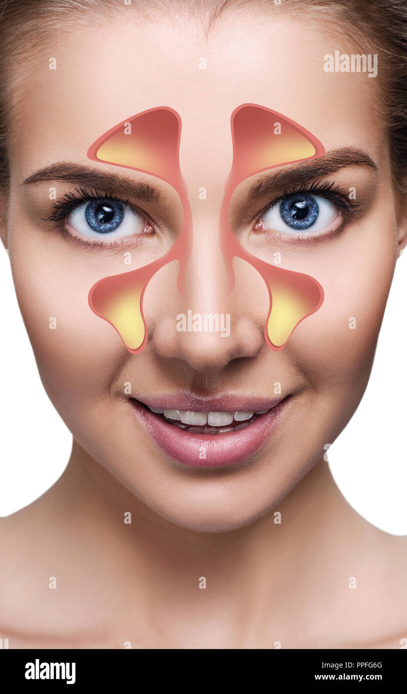 Female face shows nasal sinus with cold over white background Stock ...