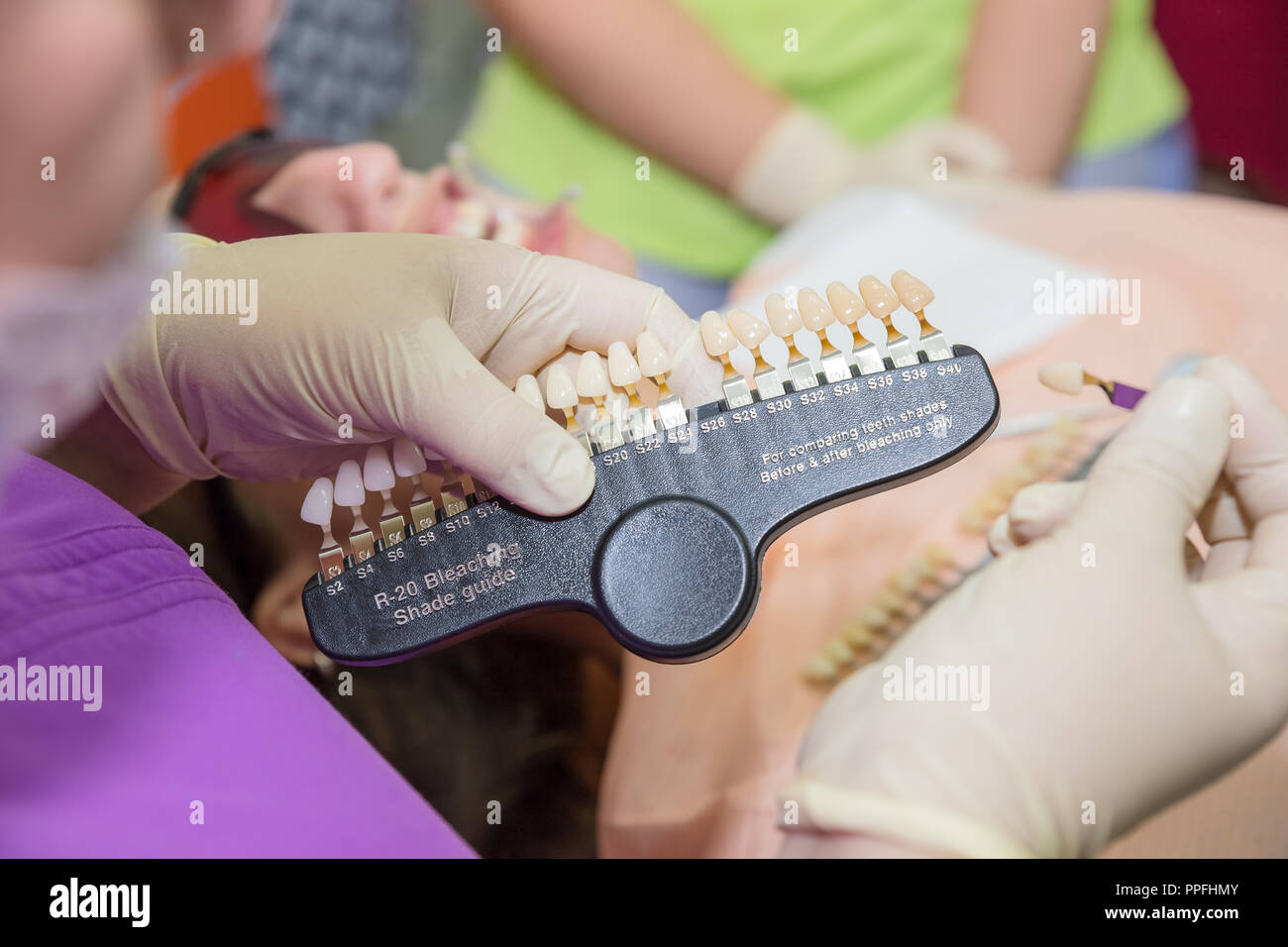 Beautiful smile and white teeth. Matching the shades of the implants or ...