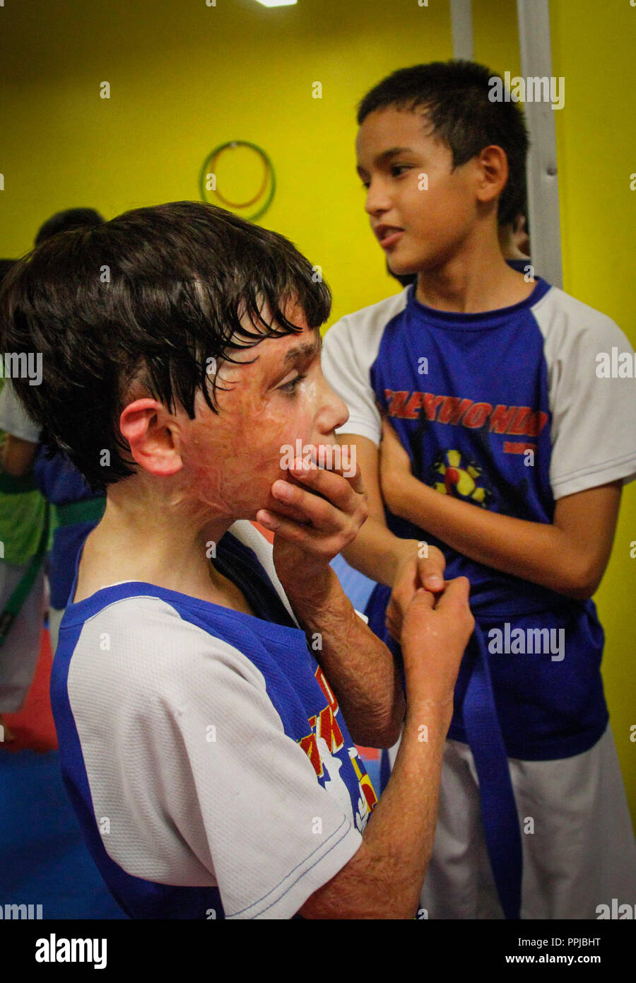 The right side of Hector 's face turned very concerned with the day ...