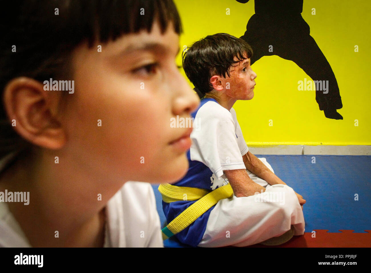 The right side of Hector 's face turned very concerned with the day ...