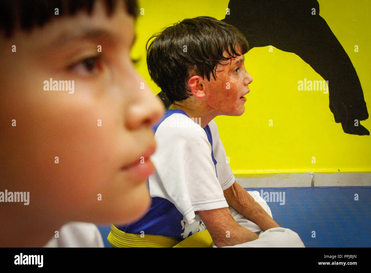 The right side of Hector 's face turned very concerned with the day ...