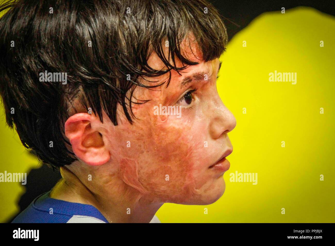 The right side of Hector 's face turned very concerned with the day ...