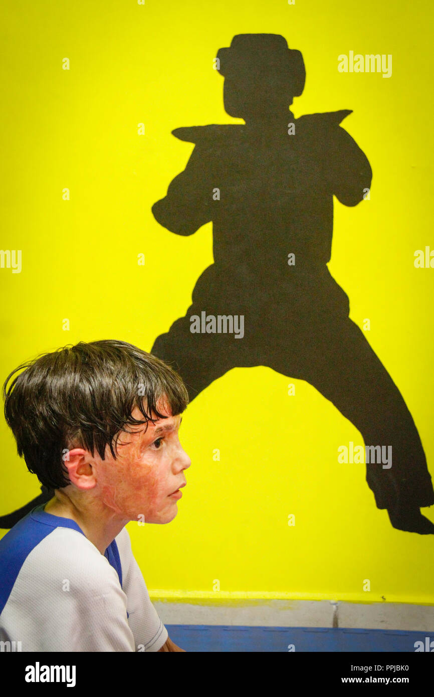 The right side of Hector 's face turned very concerned with the day ...