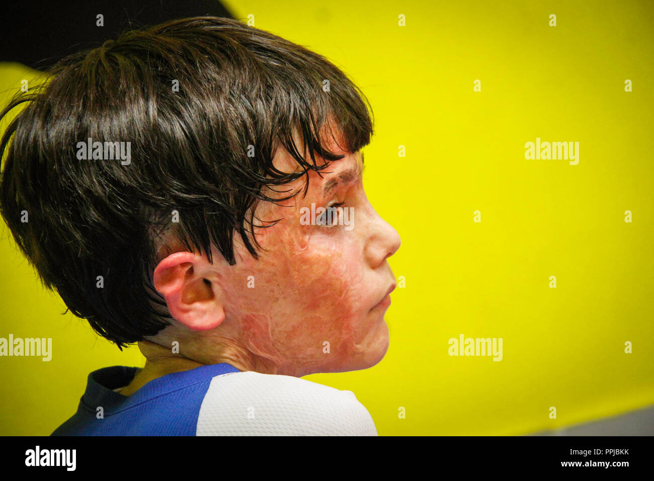 The right side of Hector 's face turned very concerned with the day ...