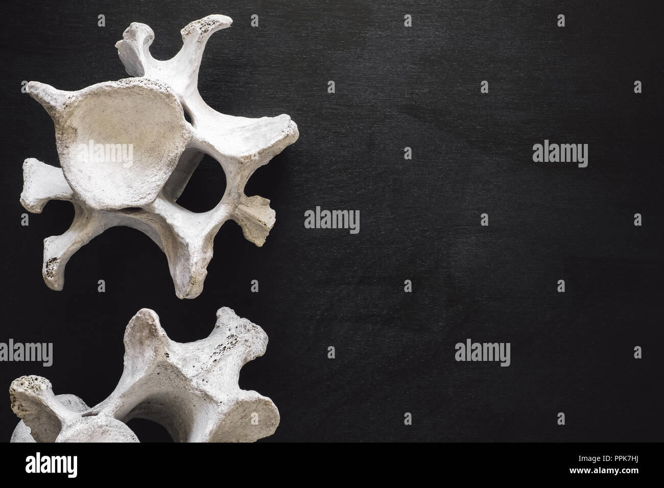 Column Vertebrae Anatomy High Resolution Stock Photography and Images ...