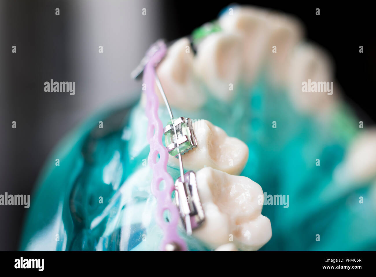 Dental metal braces teeth retainer aligners teaching orthodontics model ...