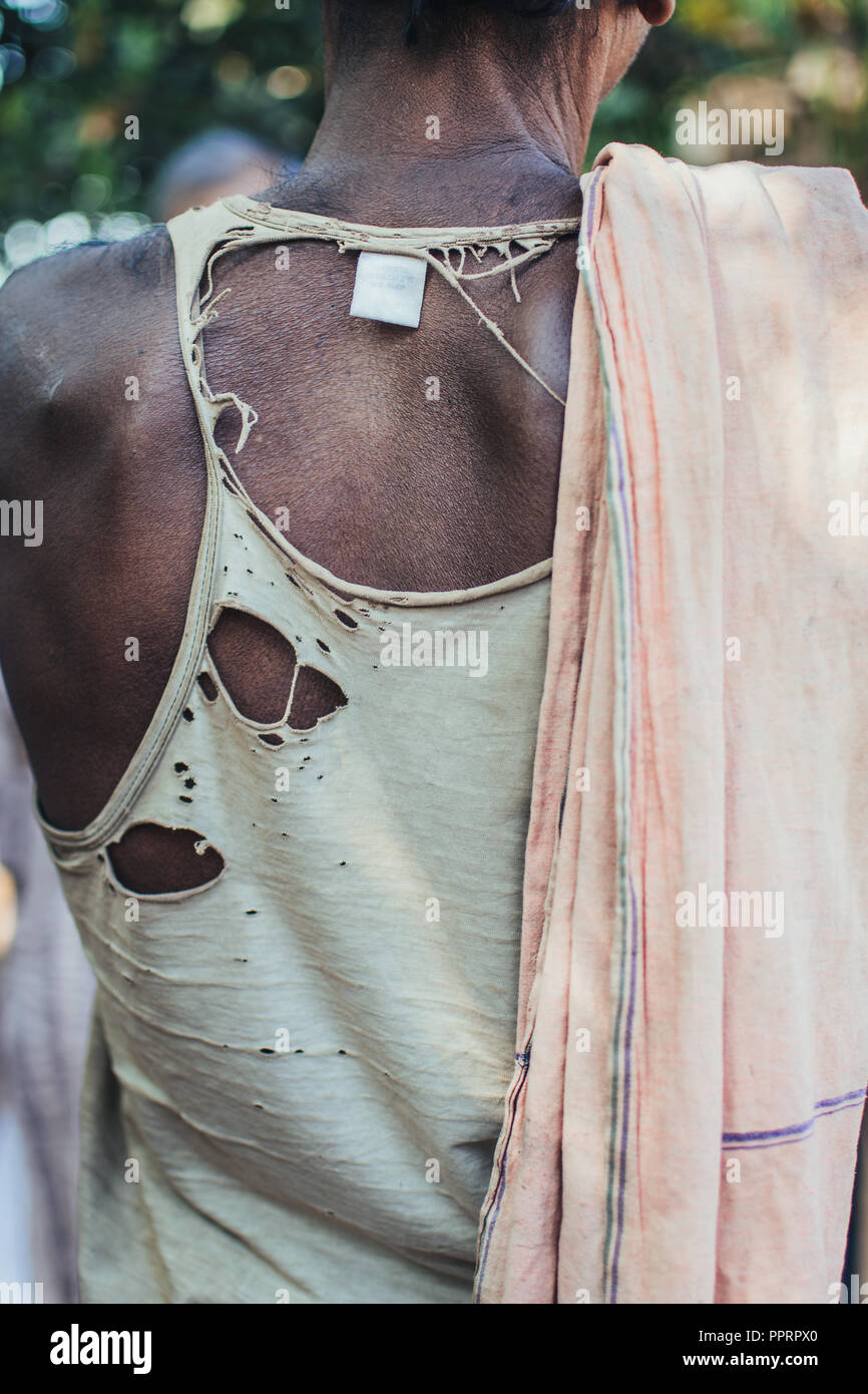 Scars of life hi-res stock photography and images - Alamy