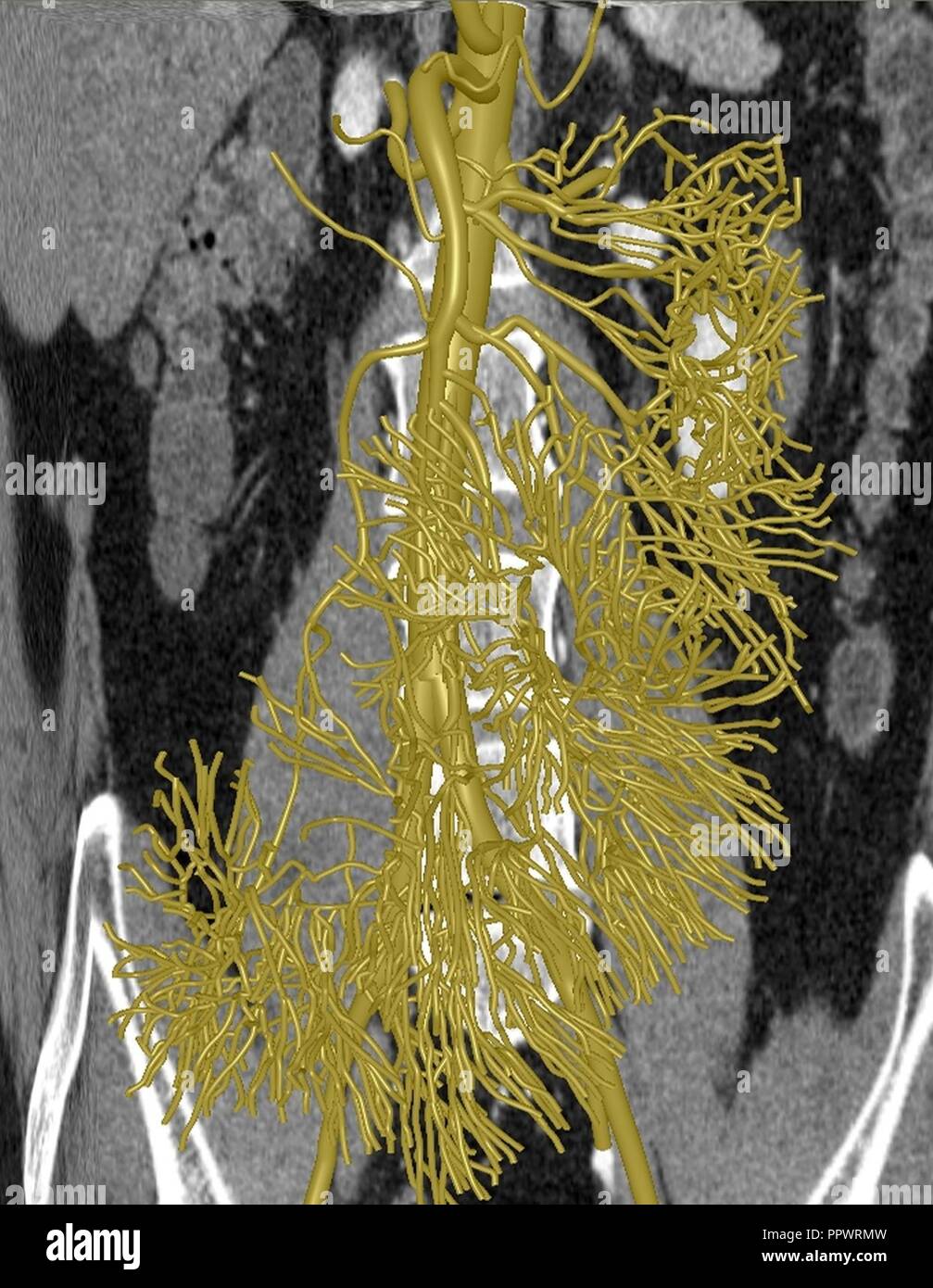 Vasculature hi-res stock photography and images - Alamy
