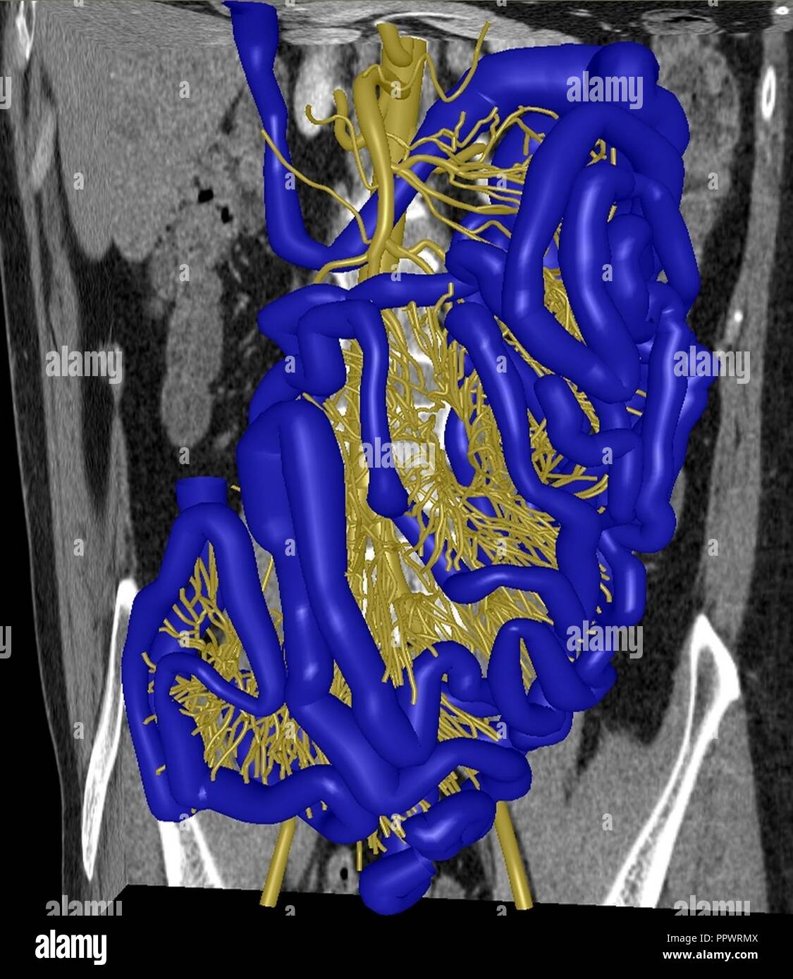 Vasculature hi-res stock photography and images - Alamy