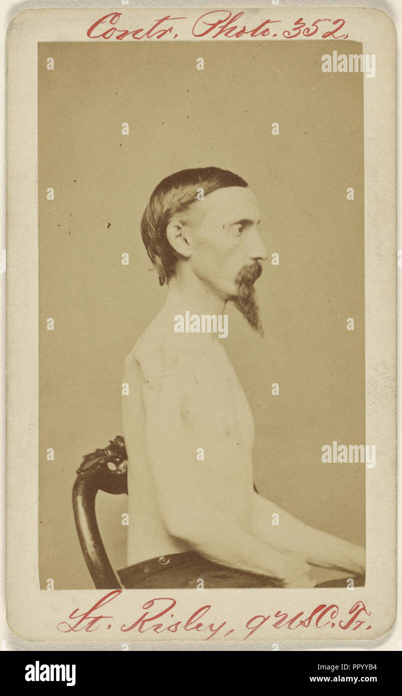 Risley q hi-res stock photography and images - Alamy