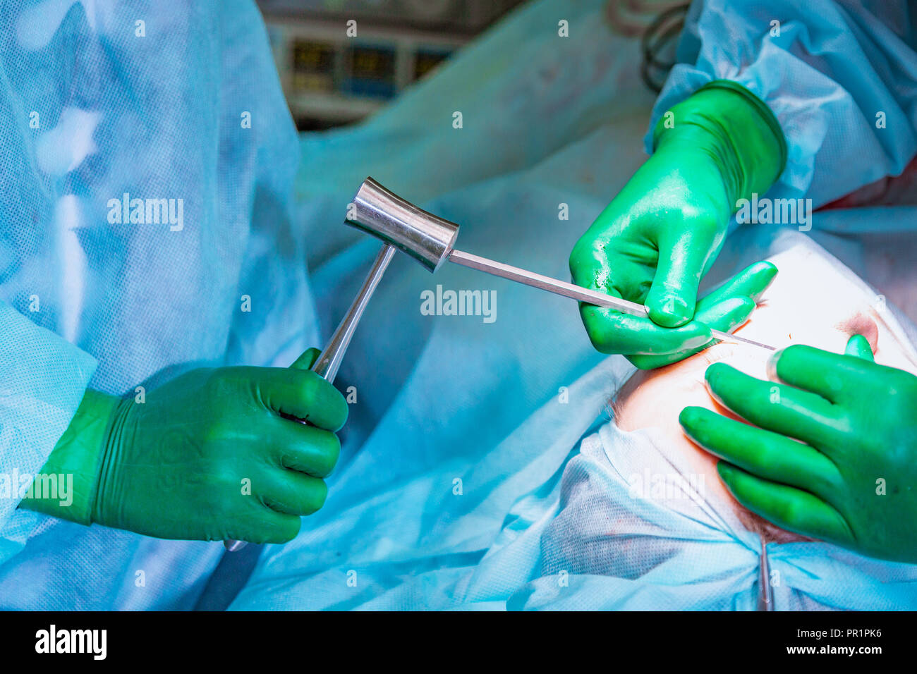 Surgeon and his assistant performing cosmetic surgery on nose in ...