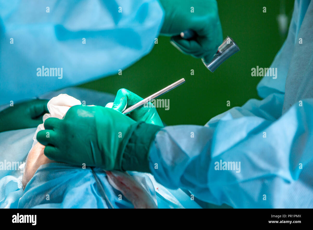 Surgeon and his assistant performing cosmetic surgery on nose in ...