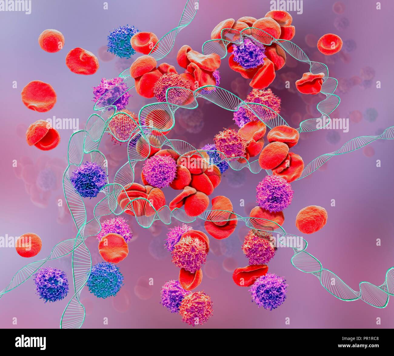 Leukaemia, conceptual composite image. Scanning electron microscopy ...