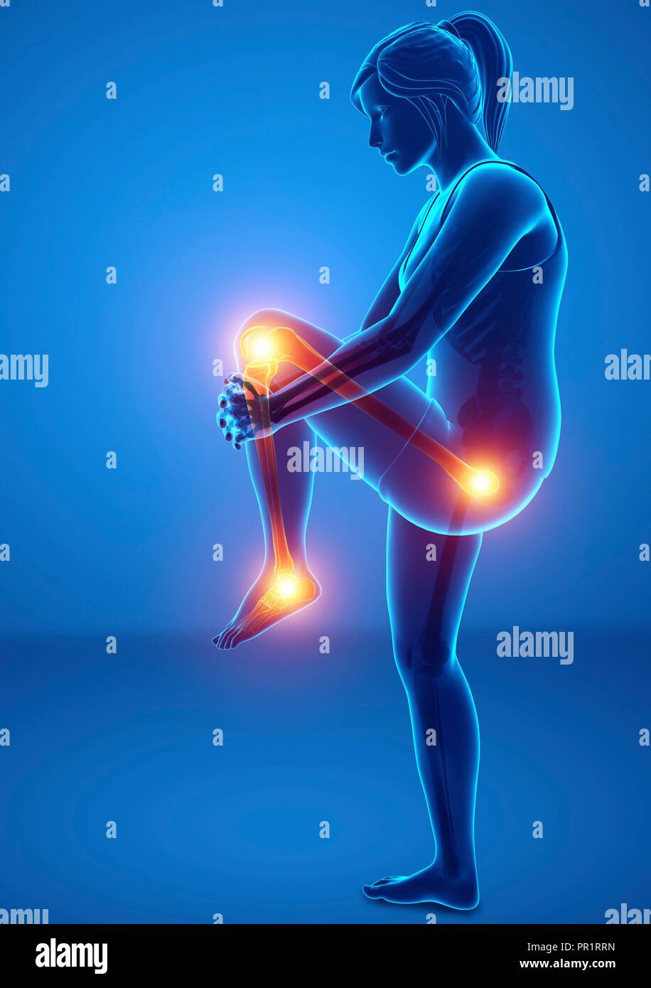 Leg pain hi-res stock photography and images - Alamy