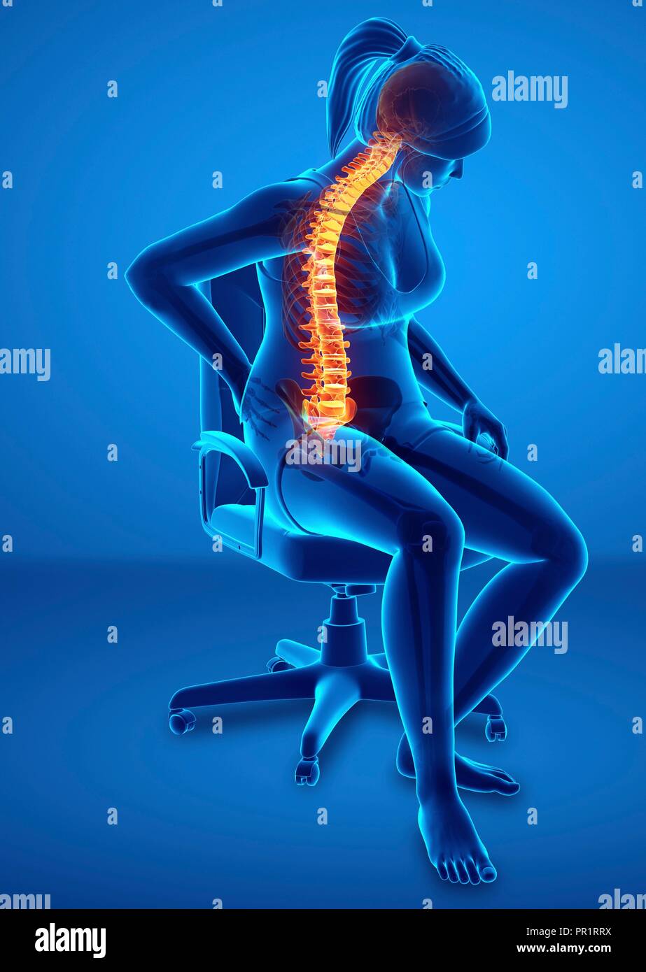 Woman with back pain, computer illustration Stock Photo - Alamy