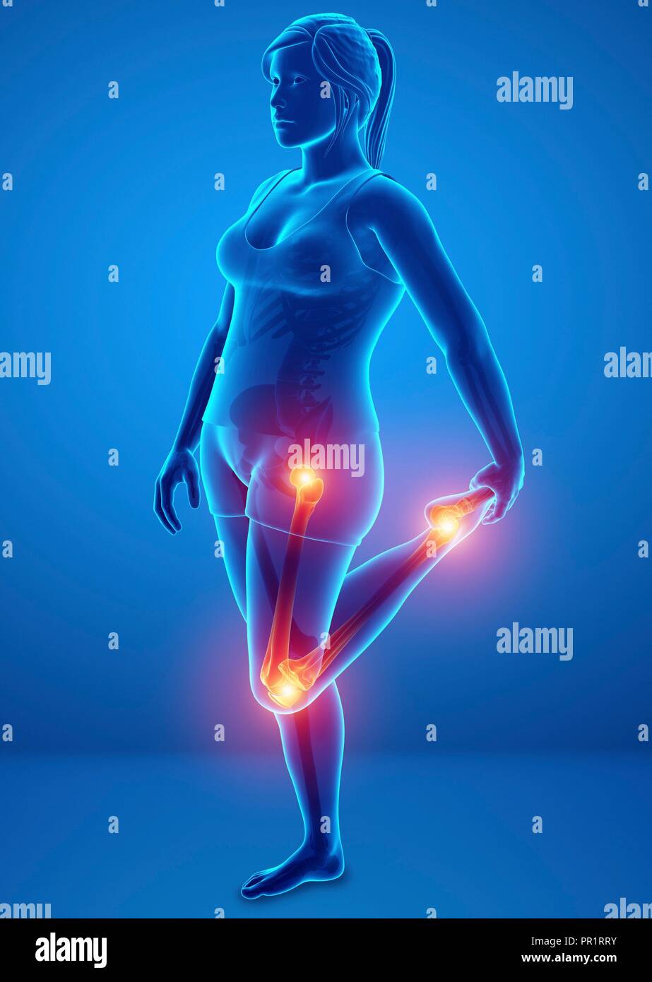 Woman with leg pain, computer illustration Stock Photo - Alamy