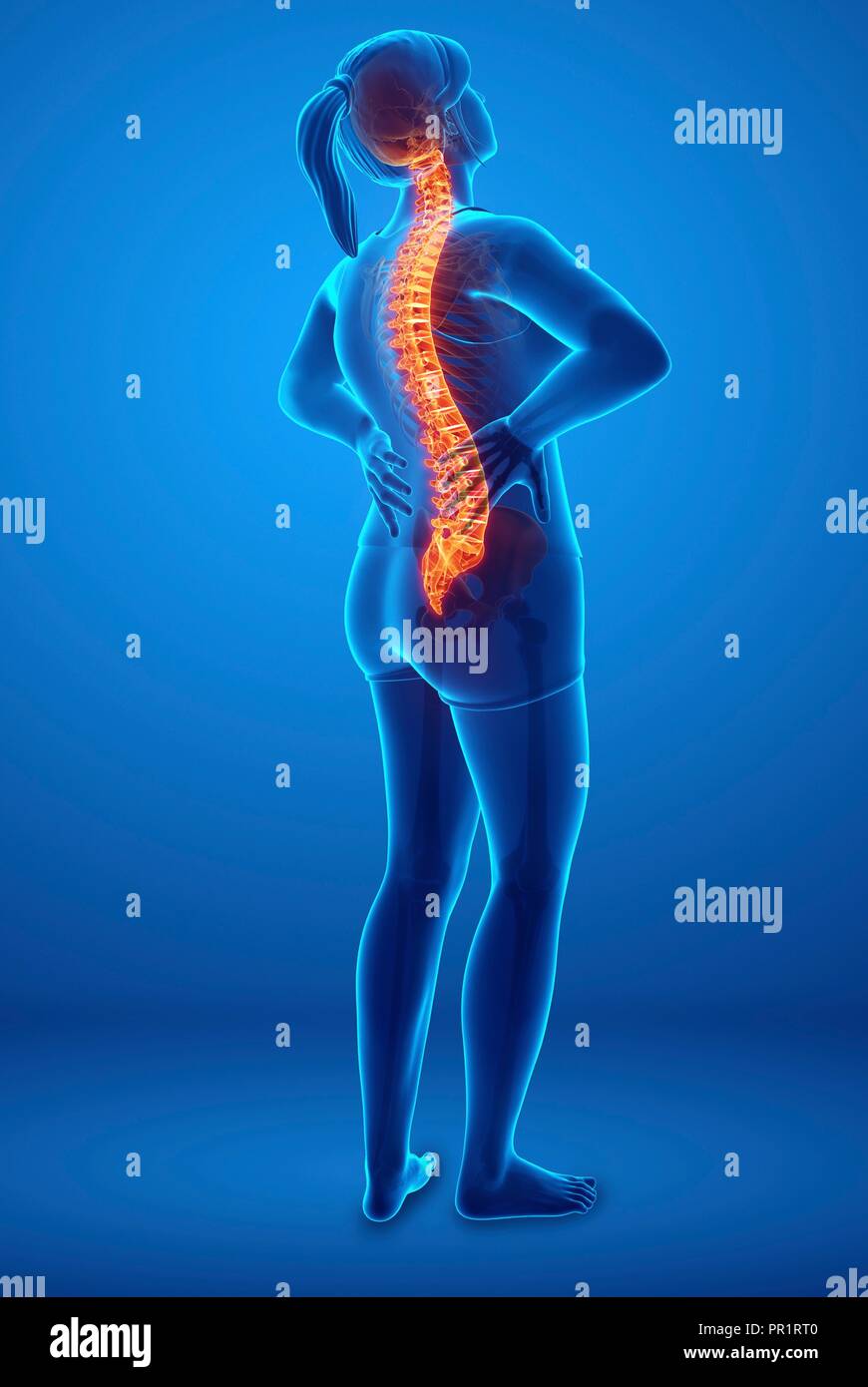 Woman with back pain, computer illustration Stock Photo - Alamy