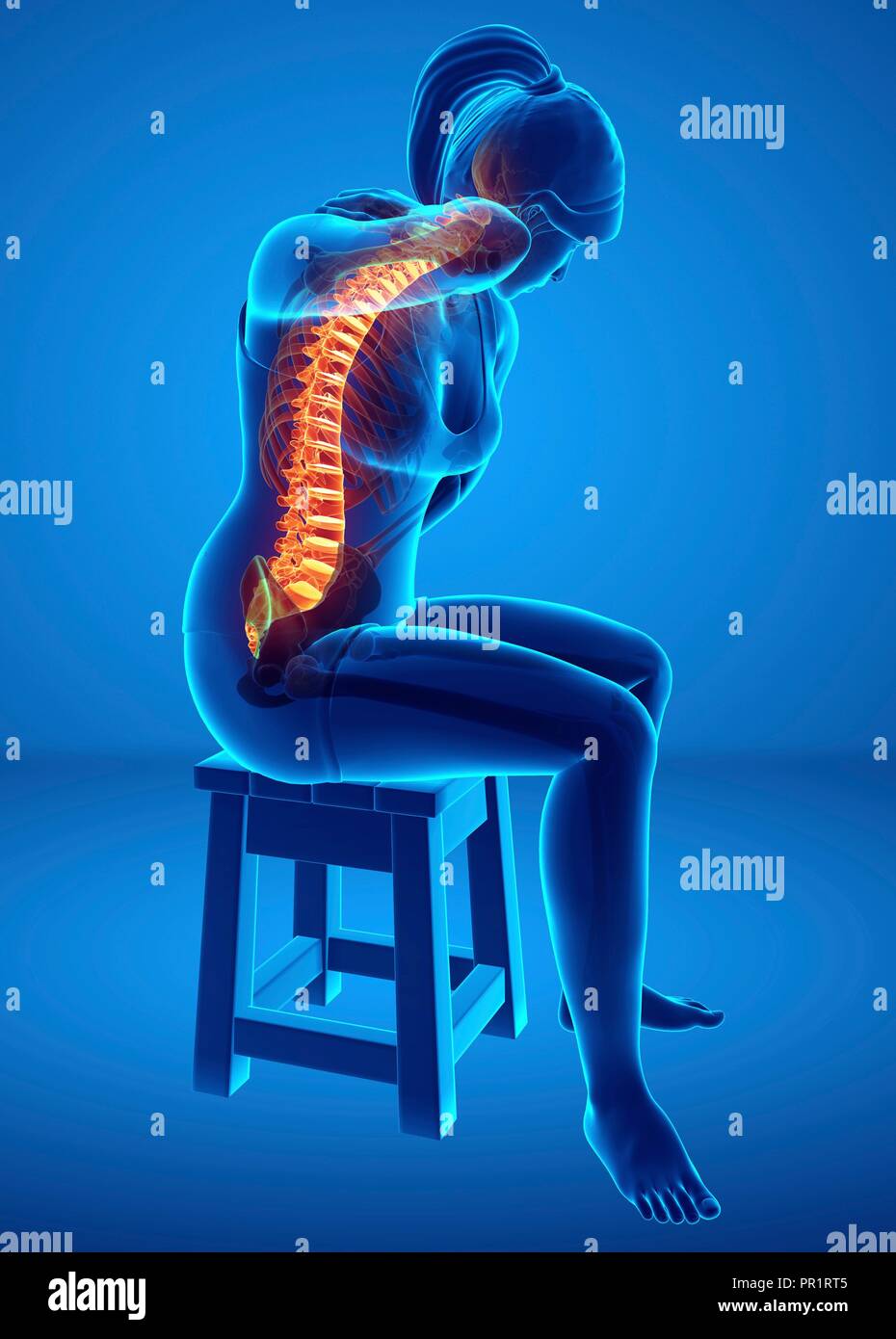 Woman with back pain, computer illustration Stock Photo - Alamy