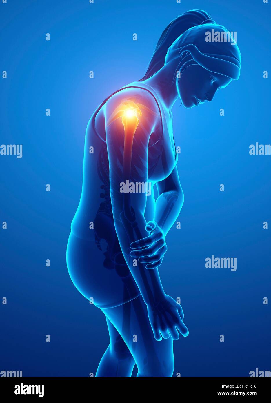 Woman with shoulder pain, computer illustration Stock Photo - Alamy