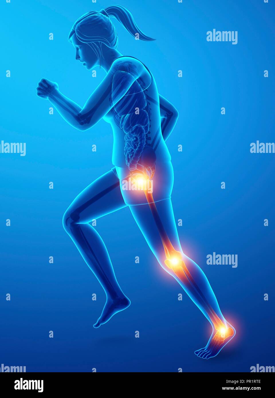 Woman with leg pain, computer illustration Stock Photo - Alamy