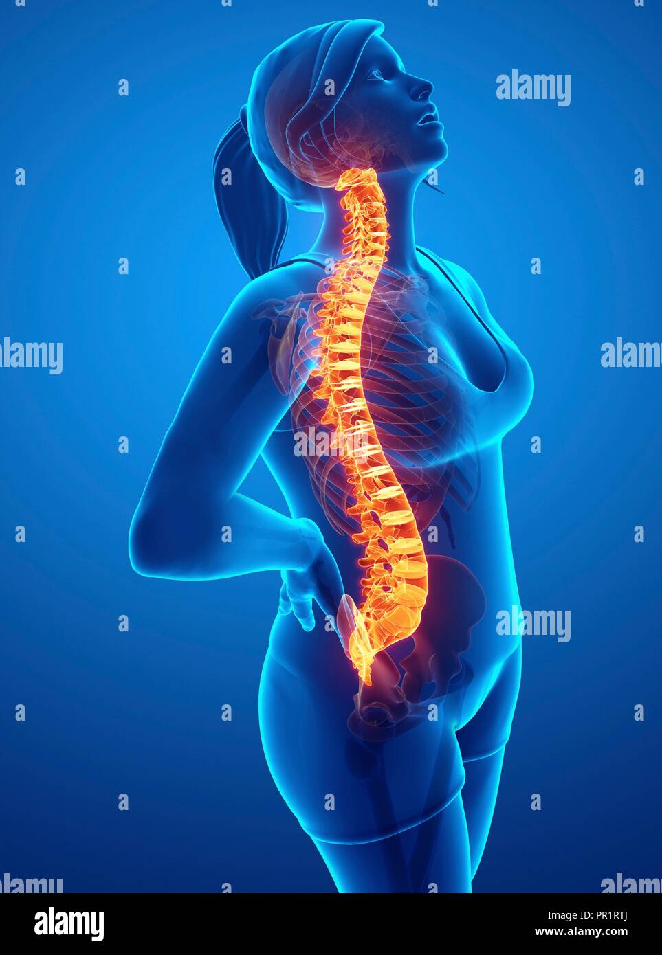 Woman with back pain, computer illustration Stock Photo - Alamy