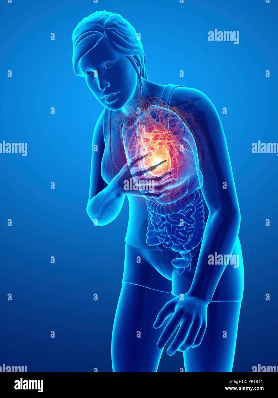 Woman with chest pain, computer illustration Stock Photo - Alamy
