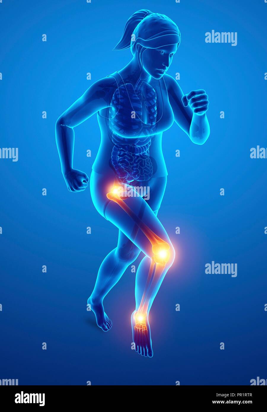 Woman with leg pain, computer illustration Stock Photo - Alamy