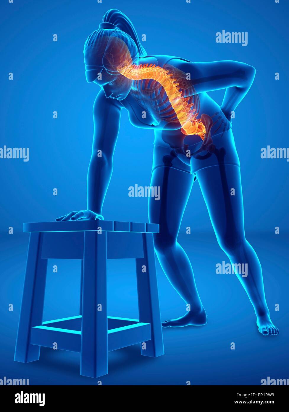 Woman with back pain, computer illustration Stock Photo - Alamy