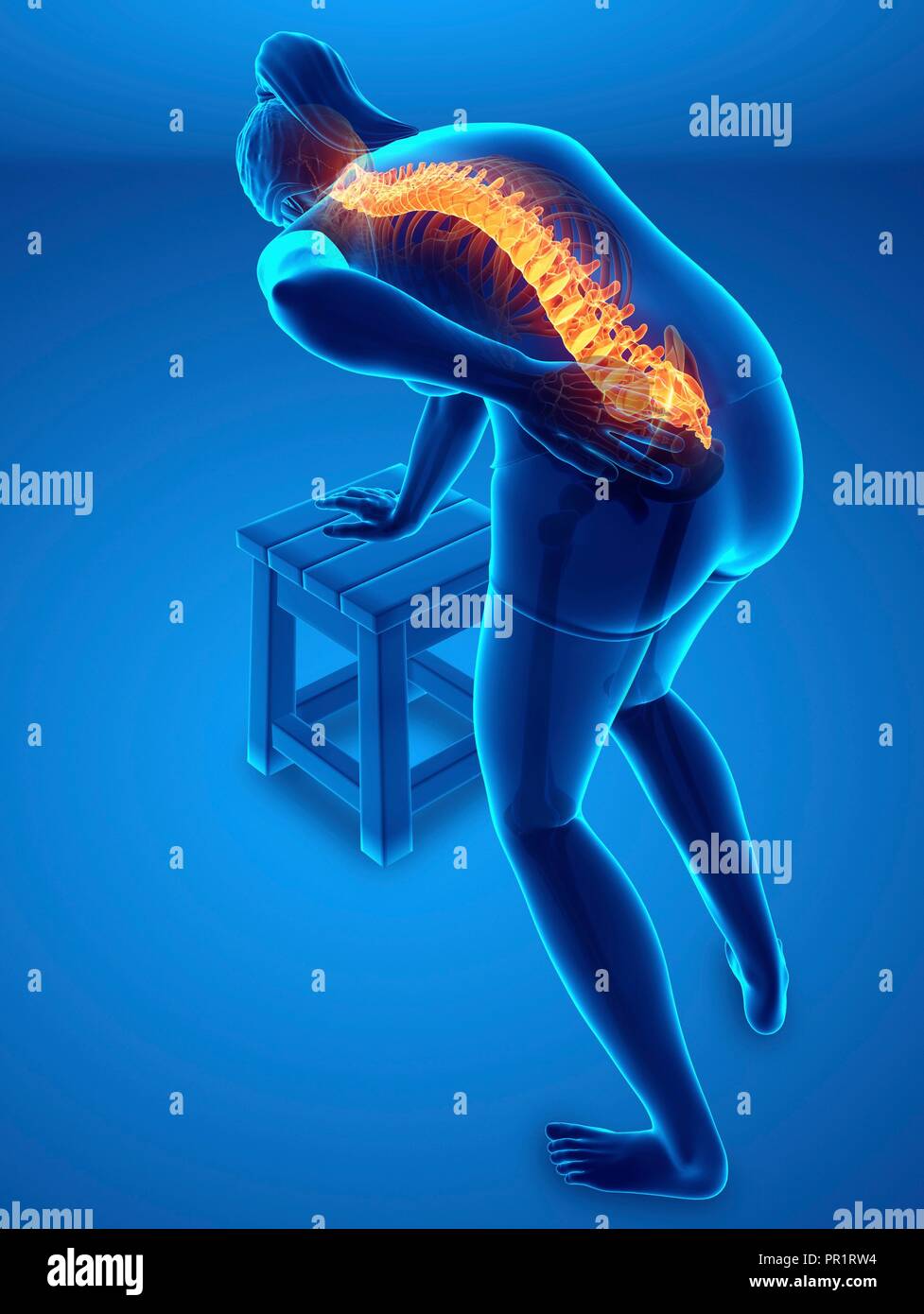 Woman with back pain, computer illustration Stock Photo - Alamy