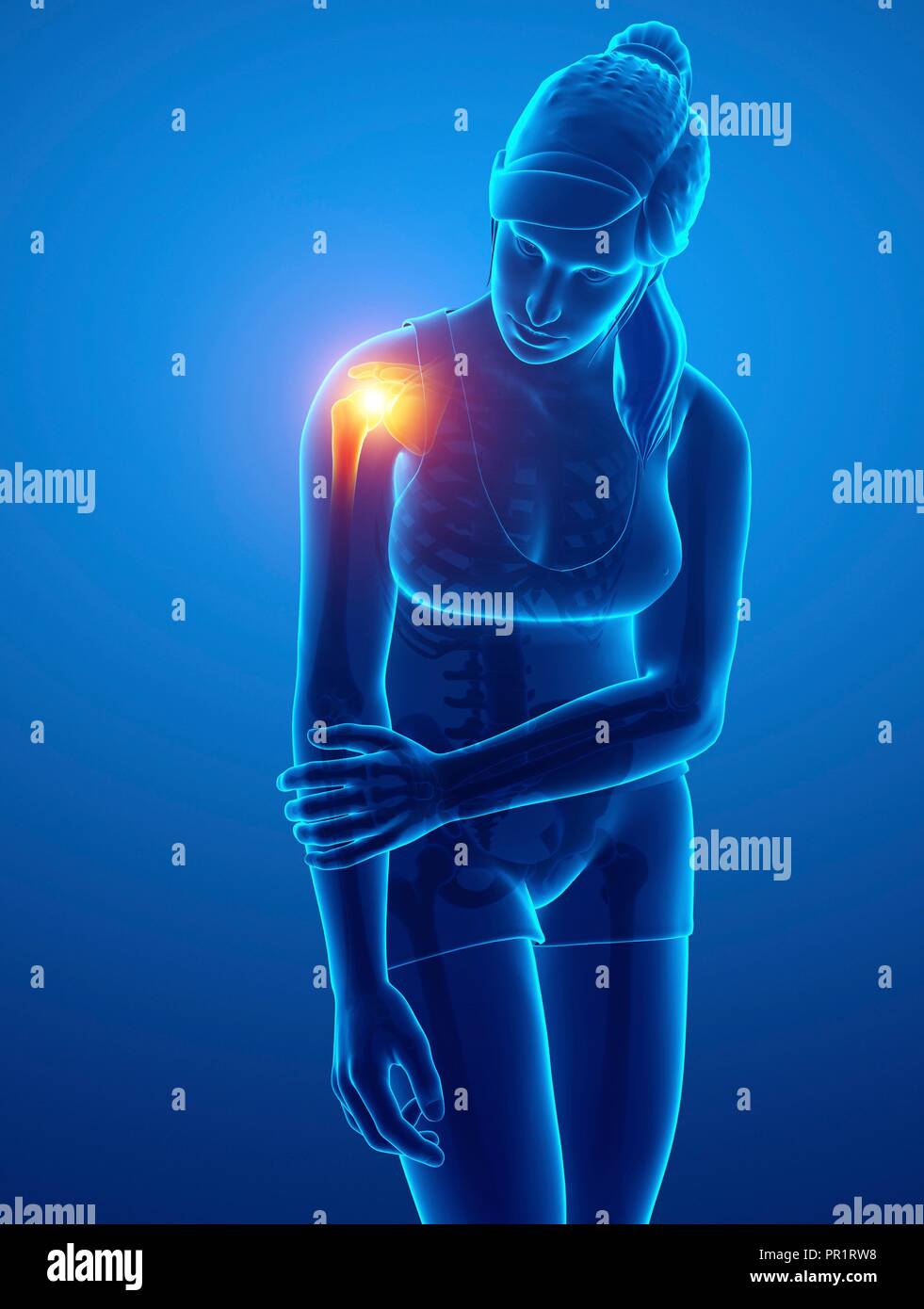 Woman with shoulder pain, computer illustration Stock Photo - Alamy