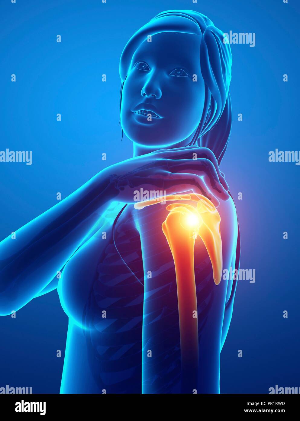 Woman with shoulder pain, computer illustration Stock Photo - Alamy