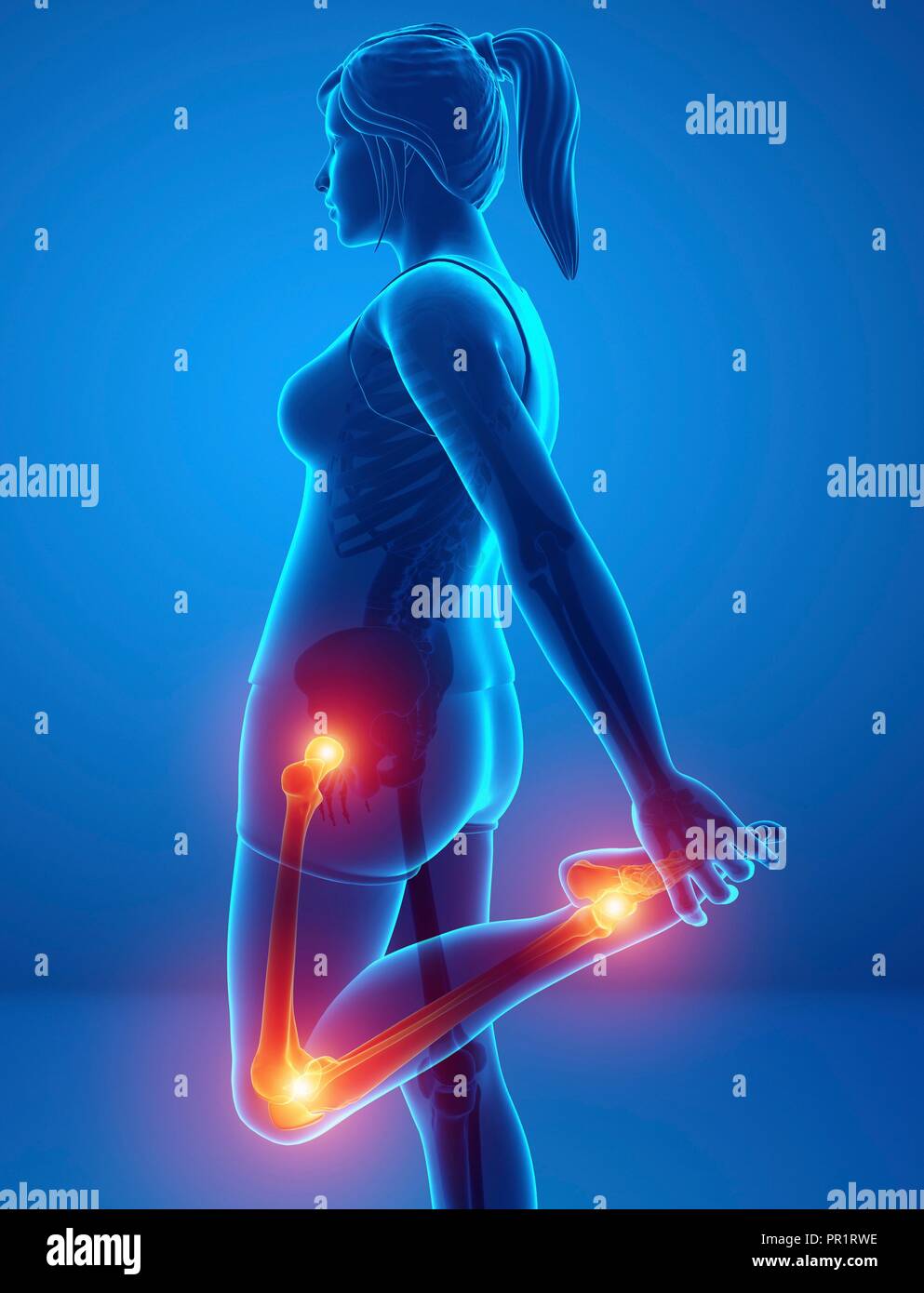 Woman sore legs illustration hi-res stock photography and images - Alamy