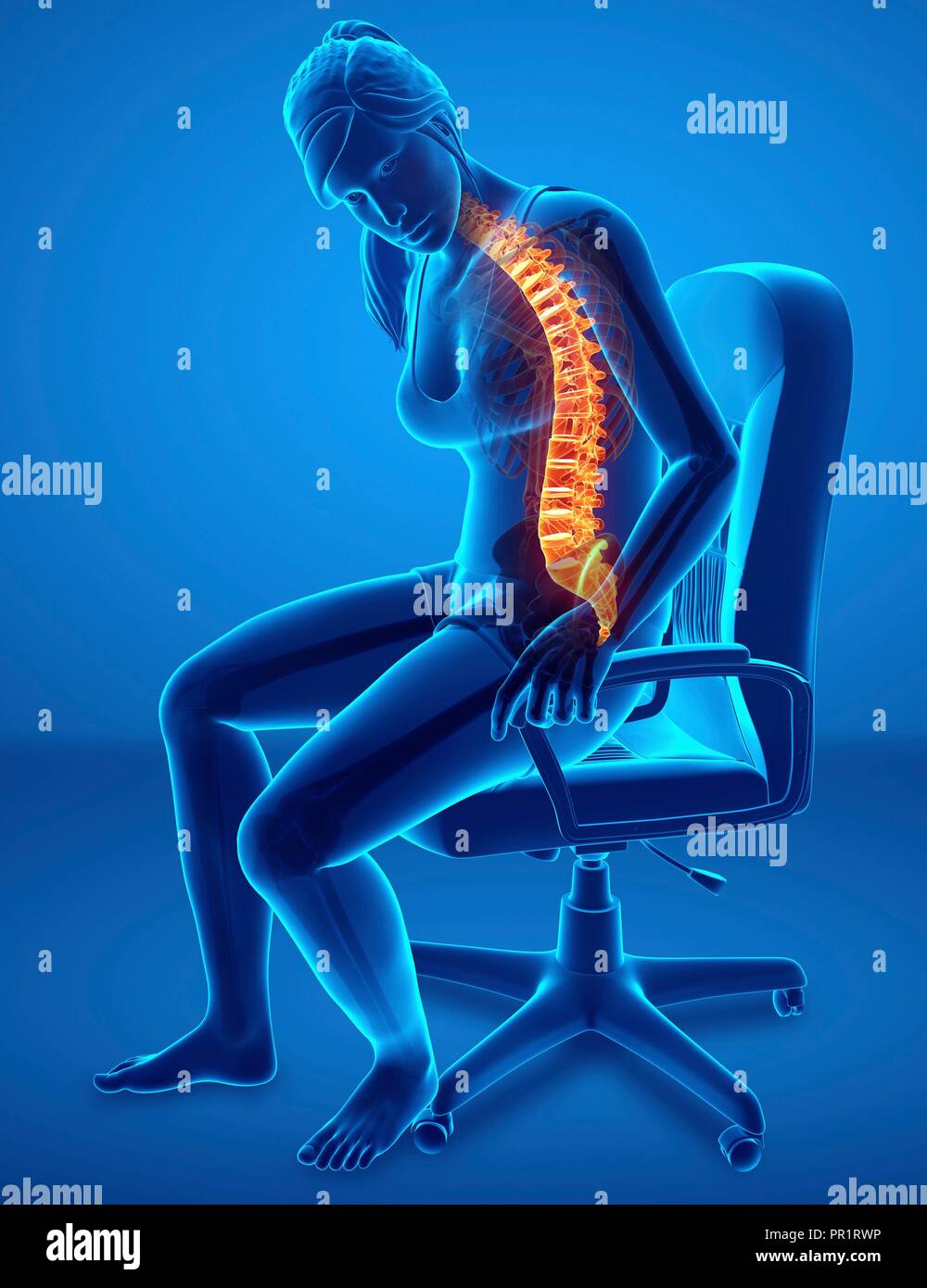 Woman with back pain, computer illustration Stock Photo - Alamy