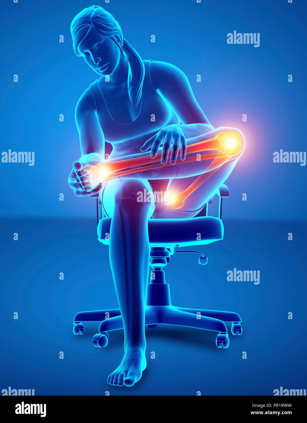 Woman with leg pain, computer illustration Stock Photo - Alamy