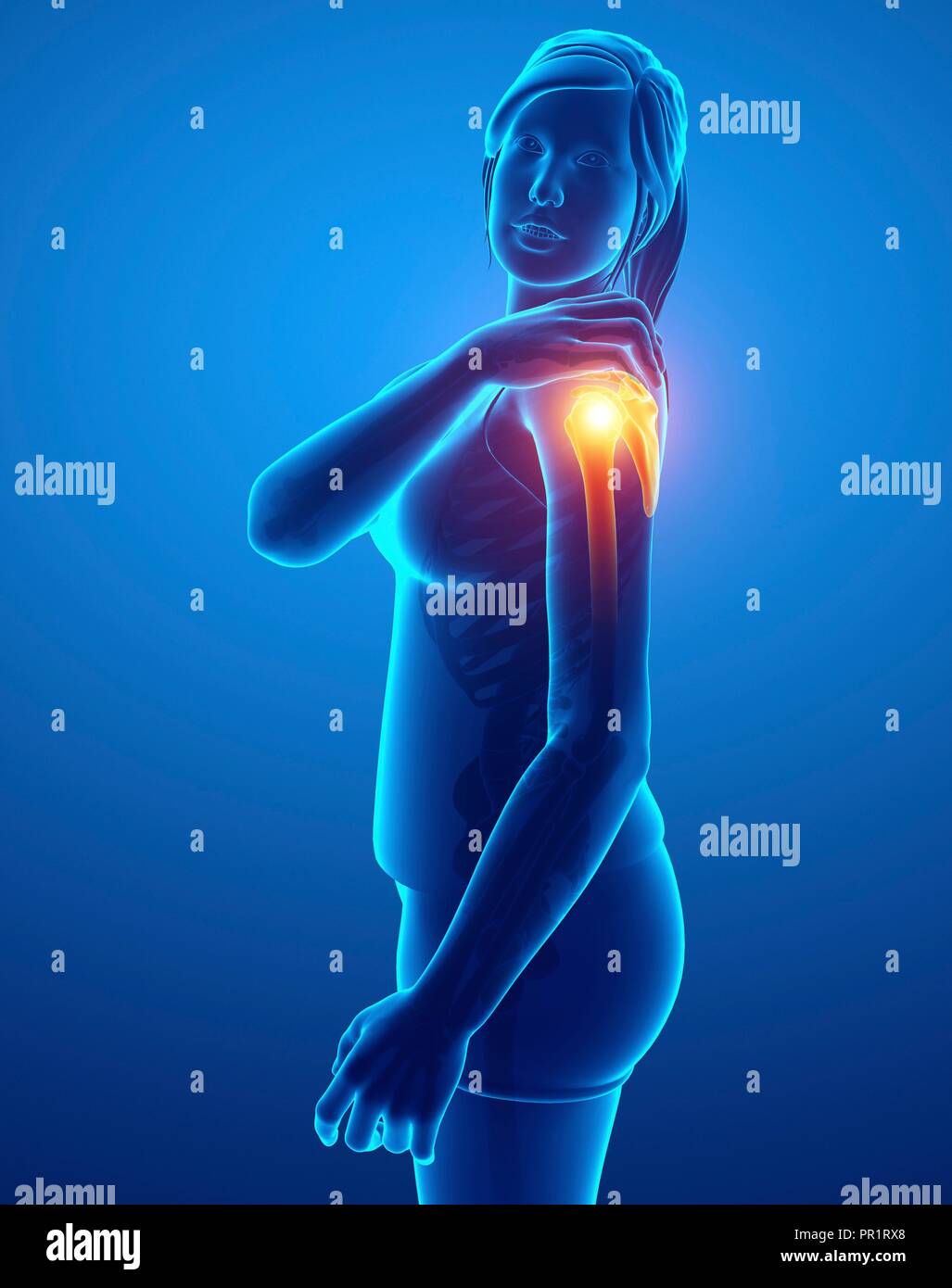 Woman with shoulder pain, computer illustration Stock Photo - Alamy