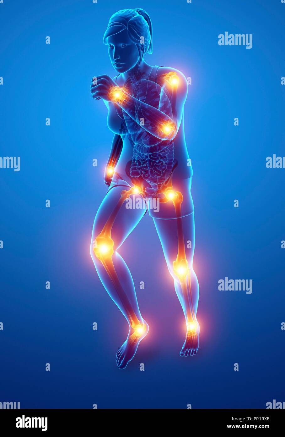 Woman Head Pain Illustration High Resolution Stock Photography and ...