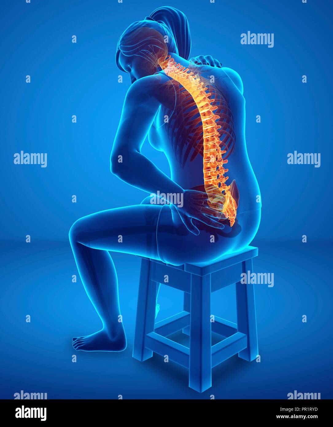 Woman with back pain, computer illustration Stock Photo - Alamy