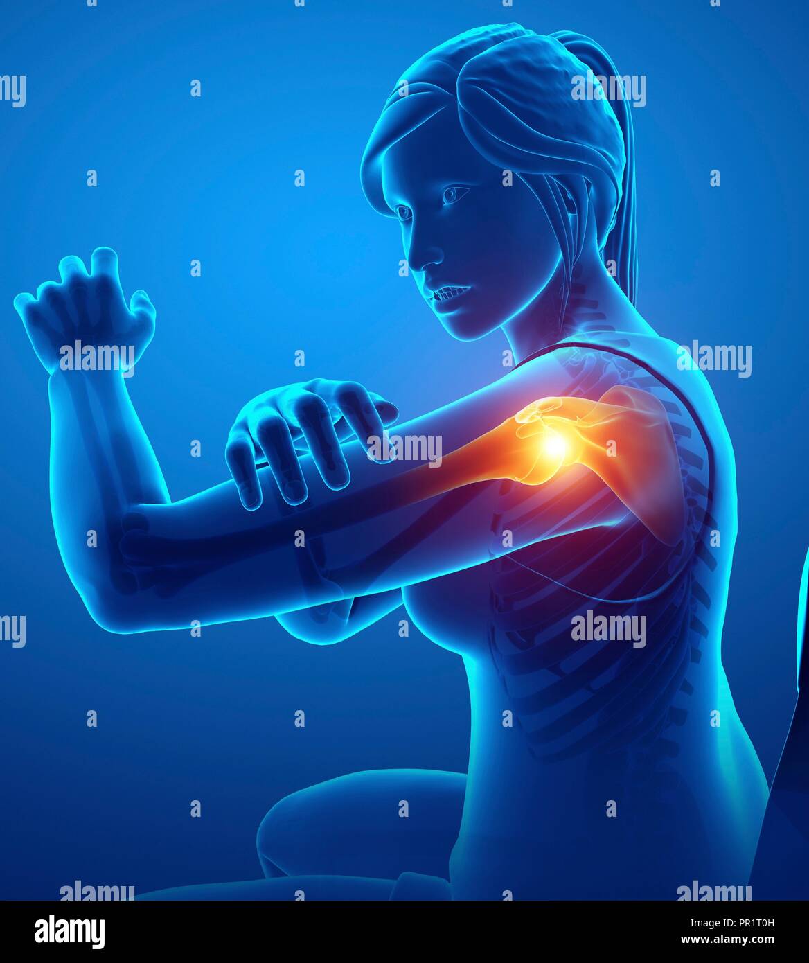 Human anatomy shoulder computer image hi-res stock photography and ...