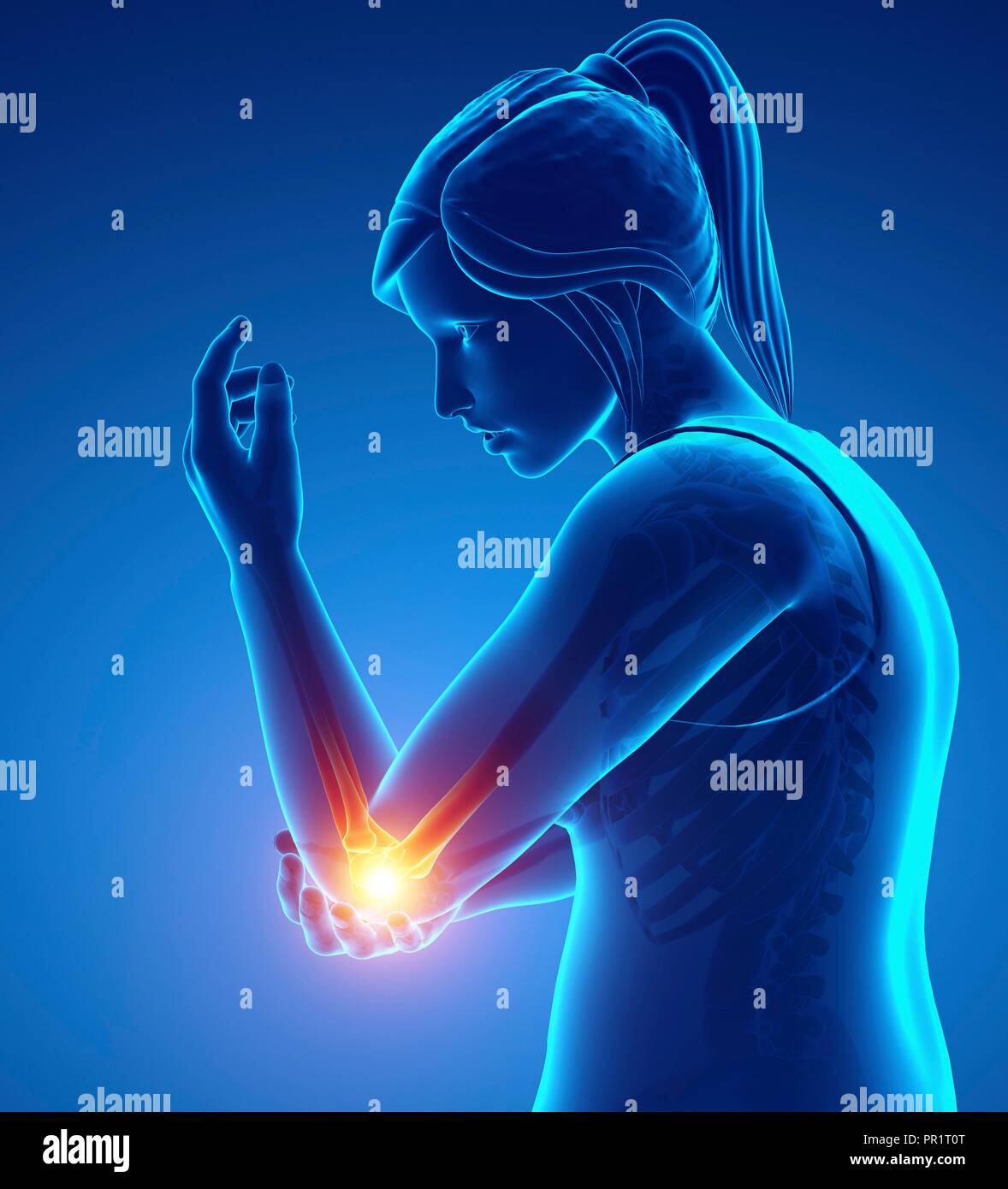 Woman with elbow pain, computer illustration Stock Photo - Alamy