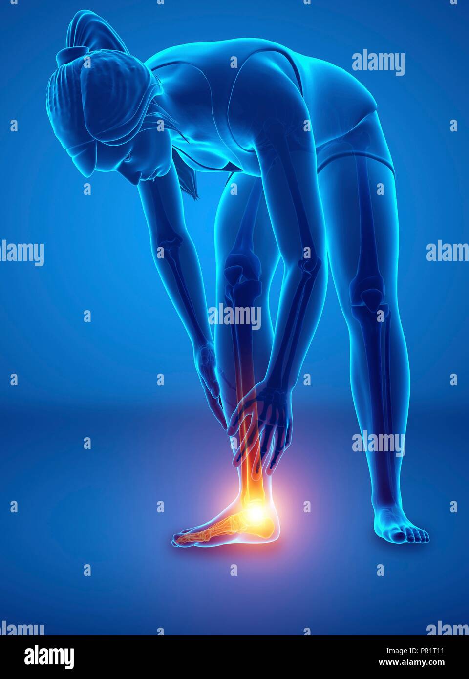 Woman with foot pain, computer illustration Stock Photo - Alamy