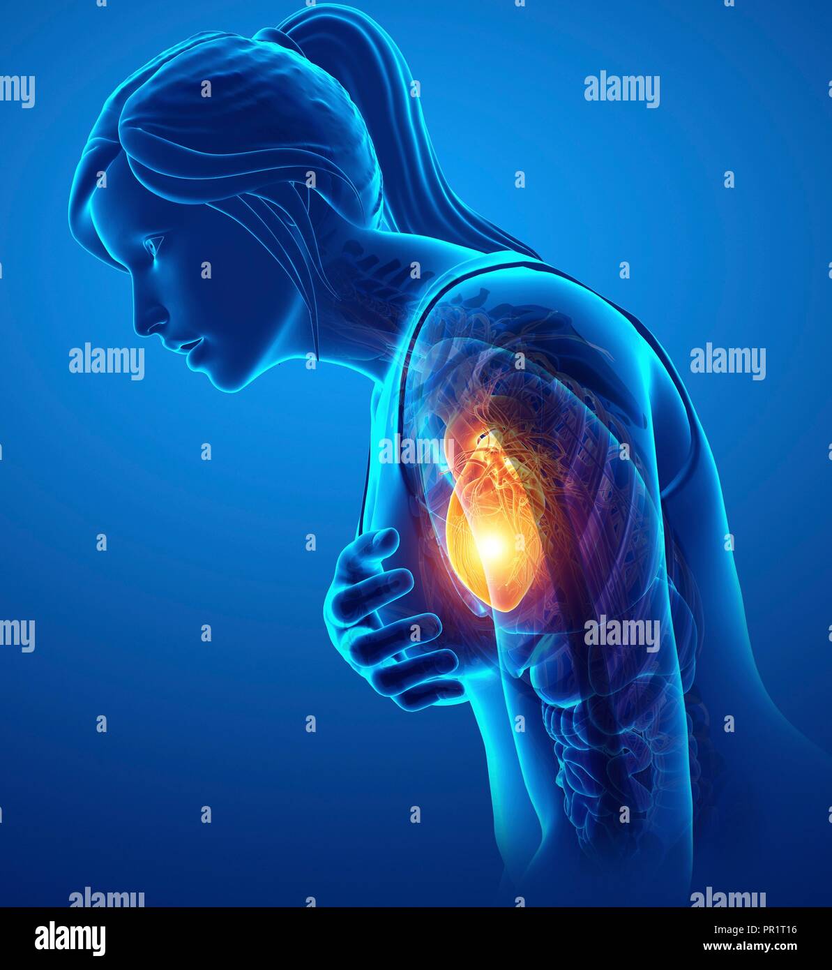 Woman with chest pain, computer illustration Stock Photo - Alamy