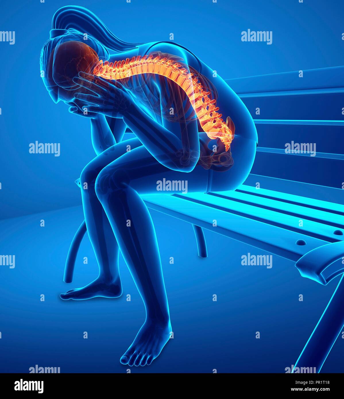 Woman with back pain, computer illustration Stock Photo - Alamy
