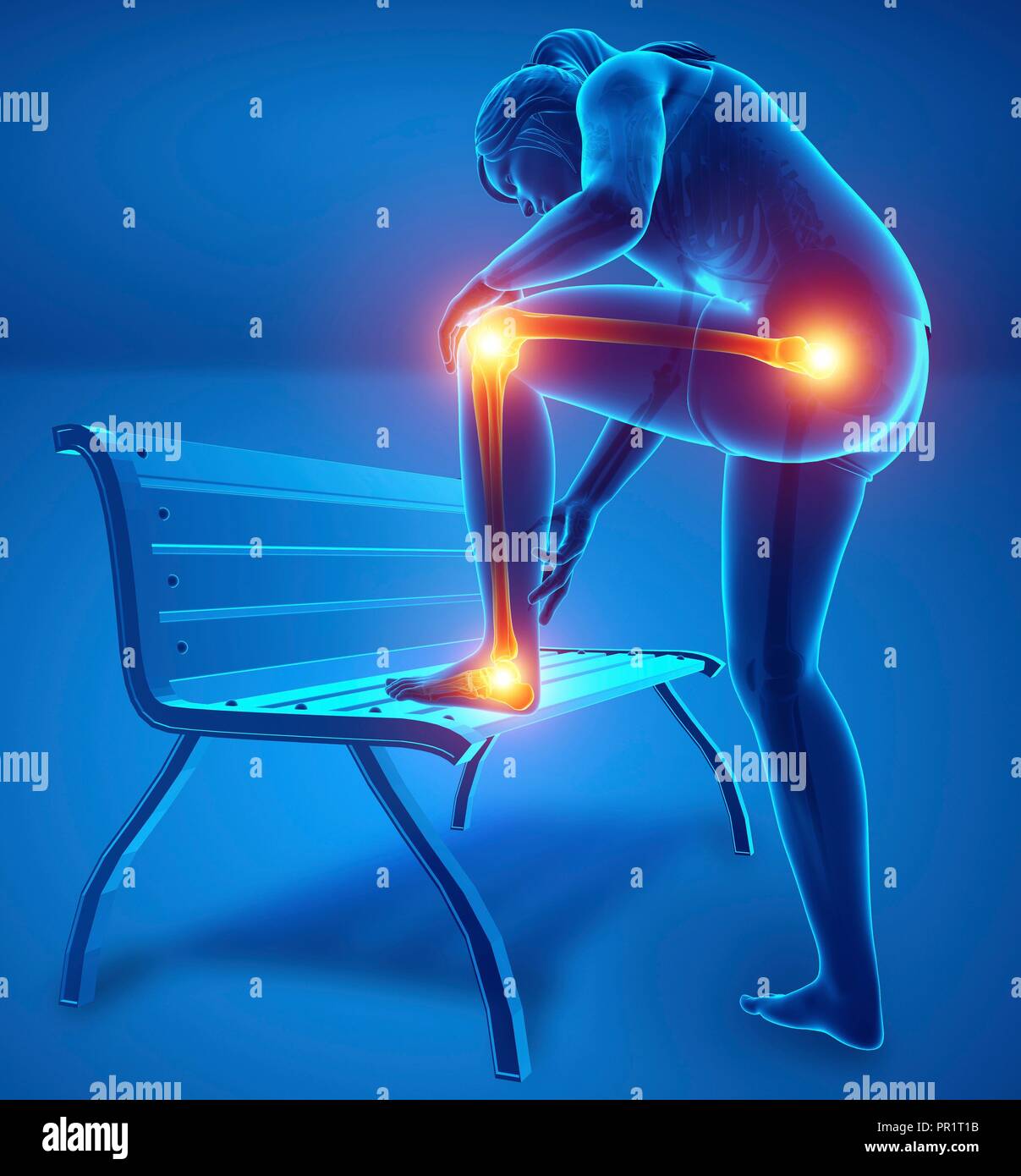 Woman with leg pain, computer illustration Stock Photo - Alamy