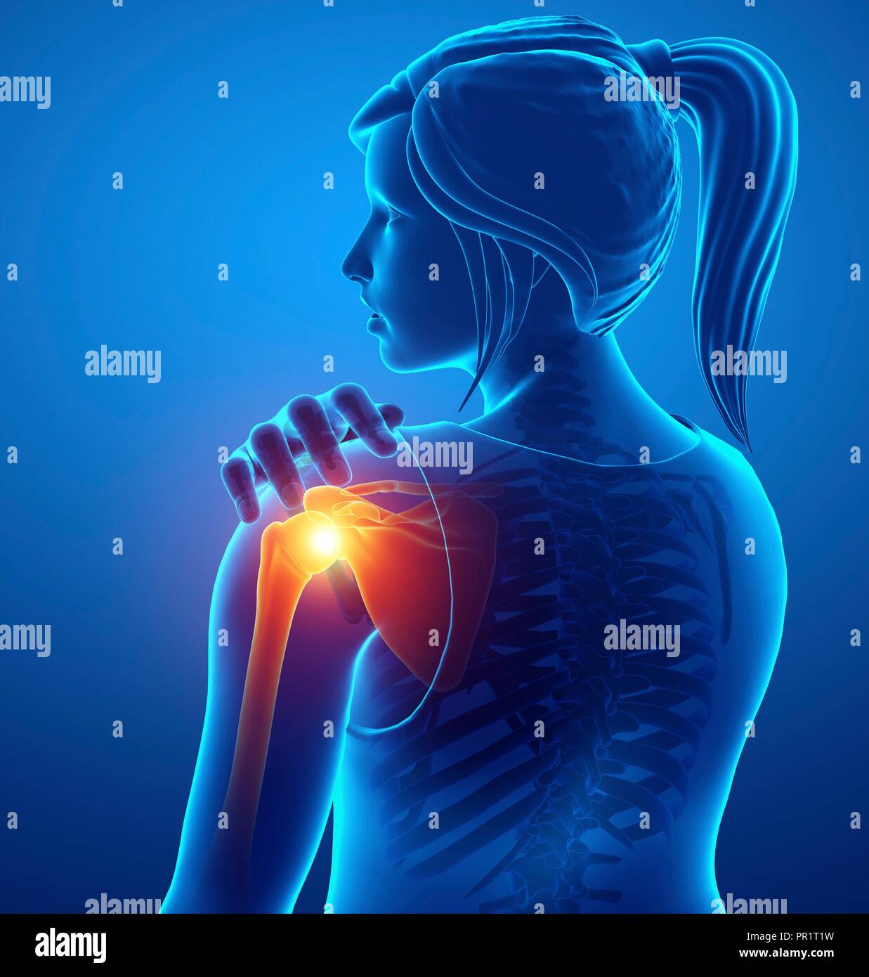 Woman with shoulder pain, computer illustration Stock Photo - Alamy
