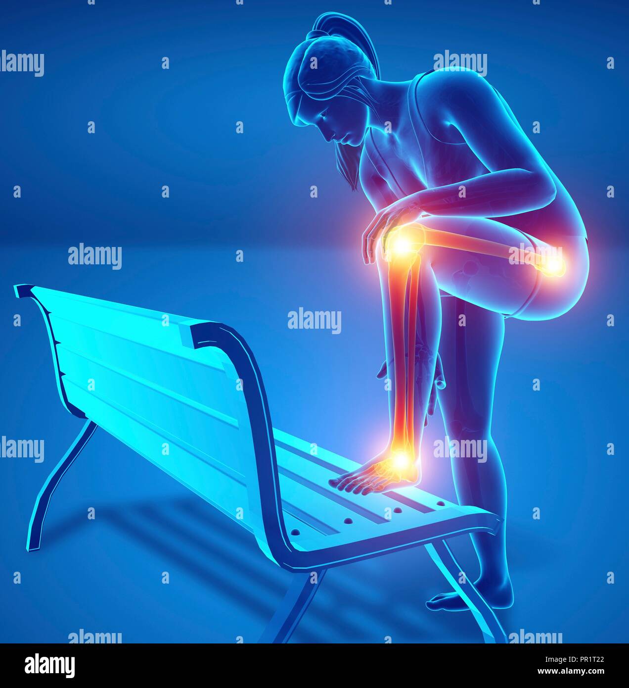 Woman with leg pain, computer illustration Stock Photo - Alamy