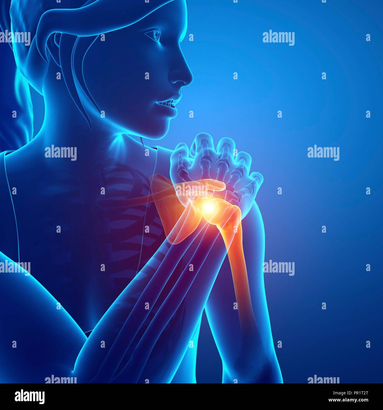Woman with shoulder pain, computer illustration Stock Photo - Alamy